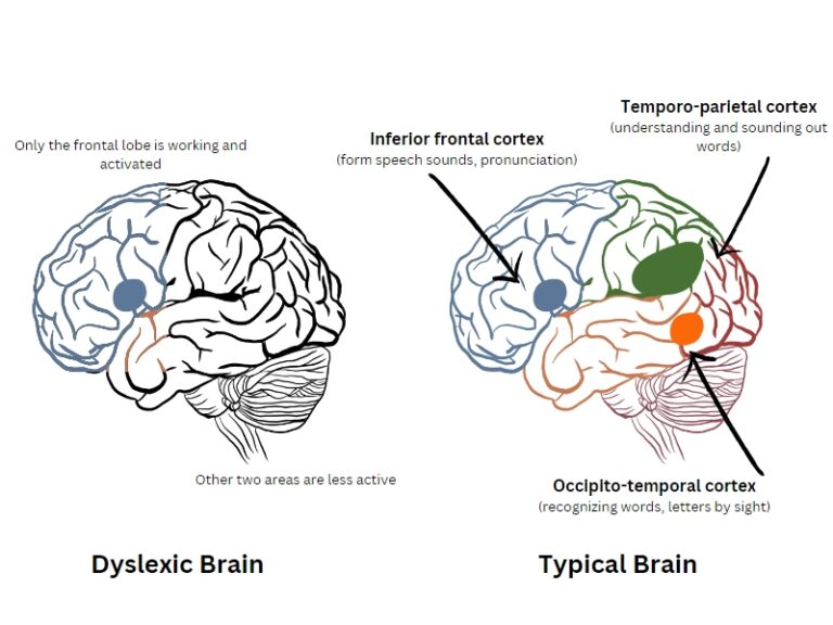 Importance Of Extra Spacing While Reading - Number Dyslexia